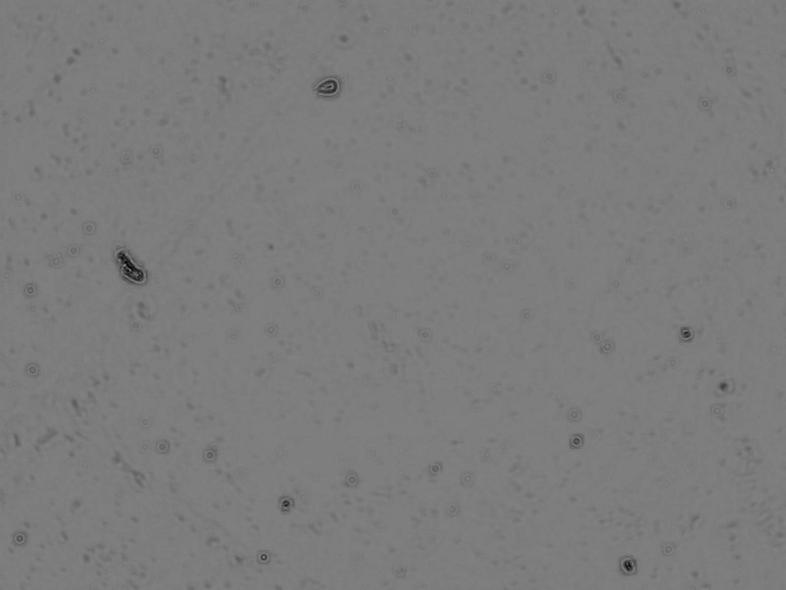bacteria growth cover – WaterScope (UK)